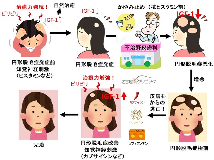 円形脱毛症の起こりかけの頭皮のピリピリ感は、治癒力の発現！ 患者様からの声・メディア掲載・クリニックからのお知らせ 名古屋kクリニック
